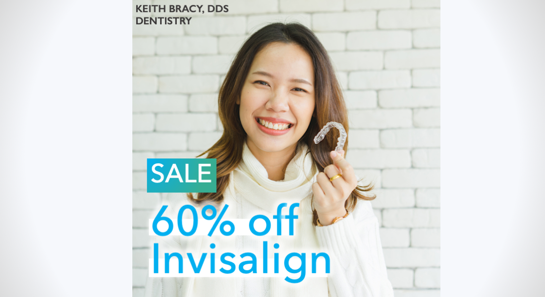 Who Is Invisalign Good For? | Keith Bracy DDS Blog 10011